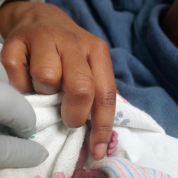 Helping Save Mothers and Babies from Illness and Death Due to Preeclampsia